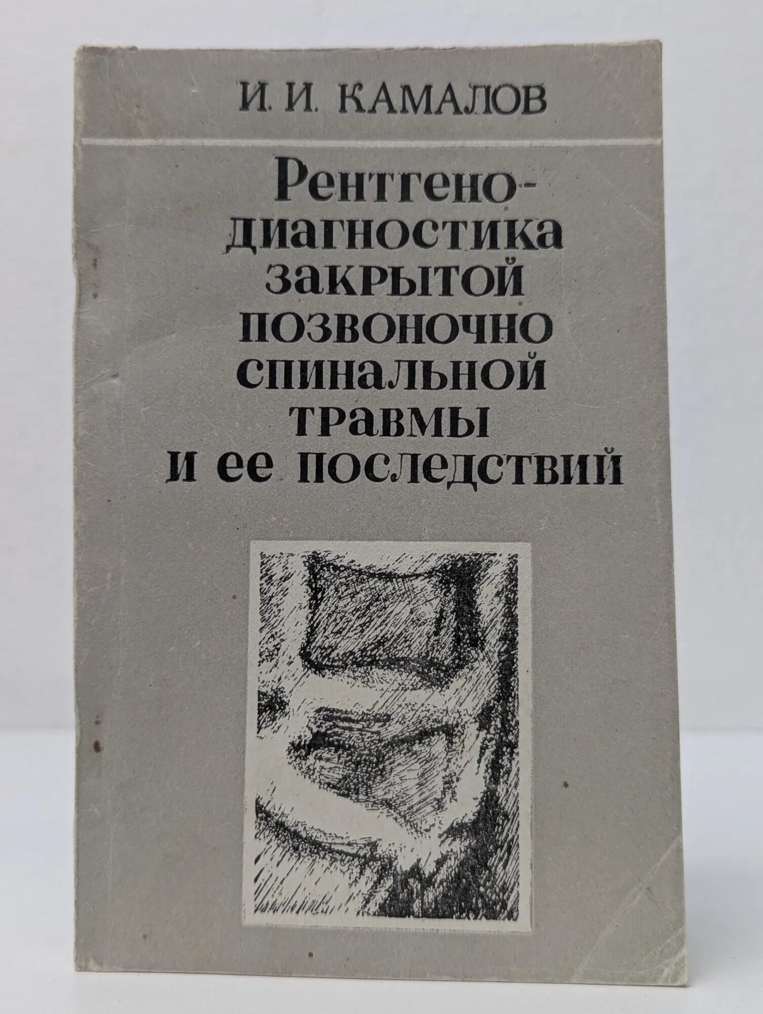 Рентгено-диагностика закрытой позвоночной спинальной травмы и ее последствий Камалов Ильдар Исхакович 1992