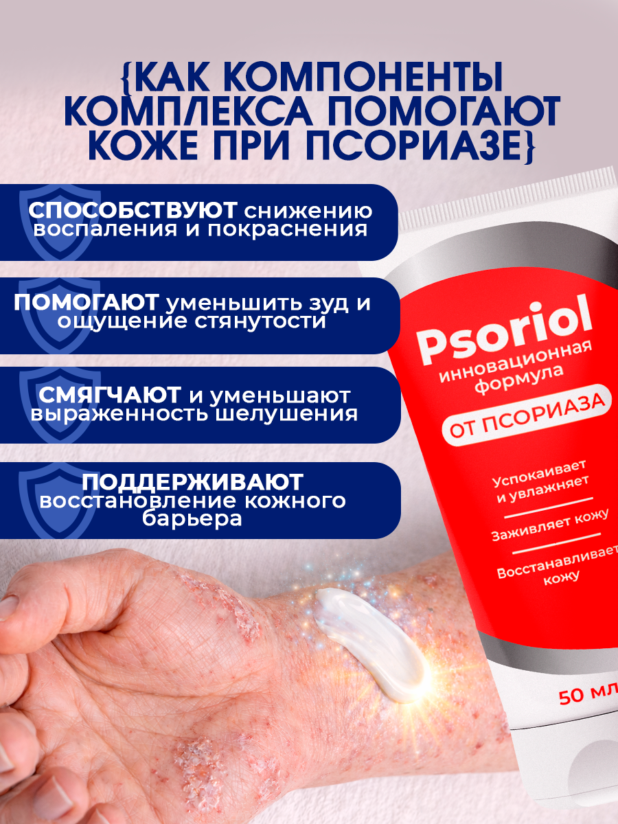 Крем от псориаза Psoriol, успокаивает, увлажняет и заживляет, натуральный состав, 50 мл