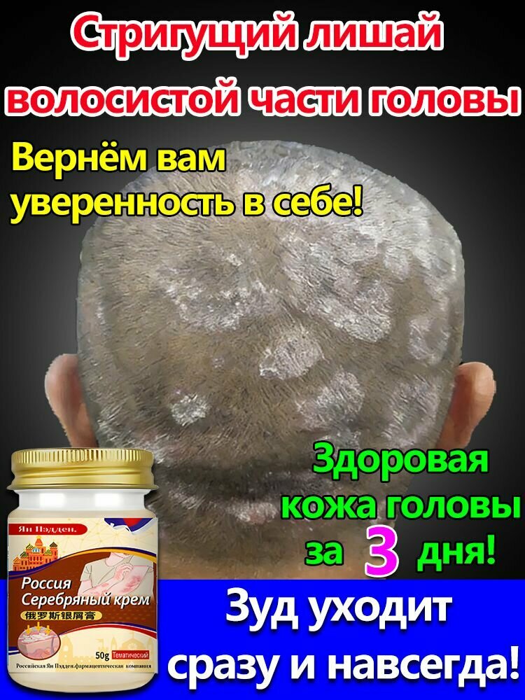 Лечебные мази от псориаза волосистой части головы