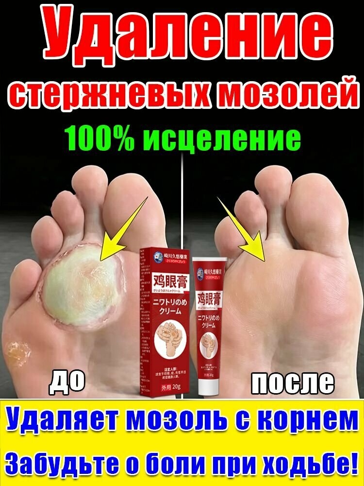 Мазь от стержневых мозолей на ногах смягчение и уход