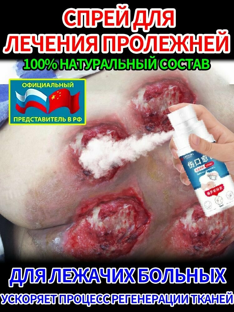 Спрей от пролежней 30 мл для ран и ожогов, Крем против пролежней и от опрелостей ранозаживляющий для лежачих больных, Средствами по уходу за больными