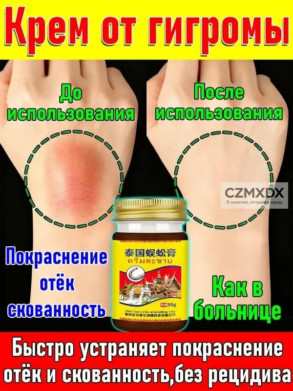 Мазь от ганглиозной кисты и воспаления сухожилий 55 г быстрое снятие боли и отёка