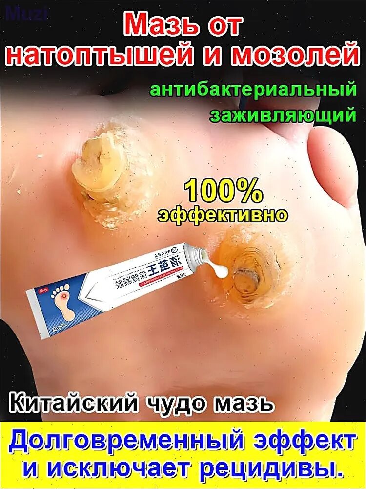Mазь от мозолей стержневых и натоптышей , Крем от сухих мозолей, шипицы, бородавок, натоптышей,20 г.