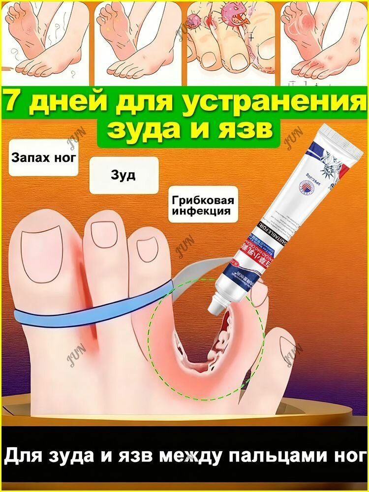Мазь от грибка ног между пальцев, мазь для лечения зуда и язв, неприятного запаха ног