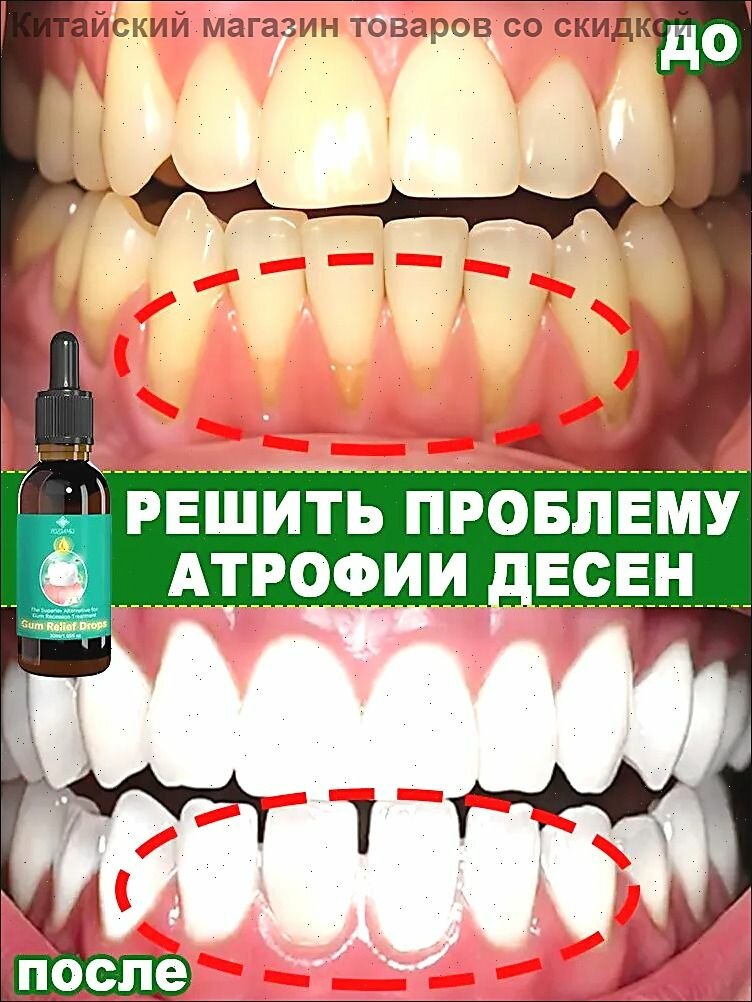 Эфирные масла для ухода за полостью рта при атрофии десен, чувствительности зубов, стоматите и уходе за деснами. Растительные экстракты. Антибактериальные средства по уходу за полостью рта.30 мл