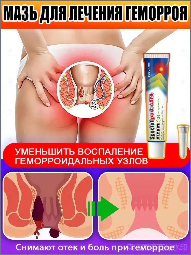 Мазь от геморроя,20 г. Быстрое обезболивание, Снимает воспаление, Убирает отек, эффективное Анальные трещины, Заживляет трещины.