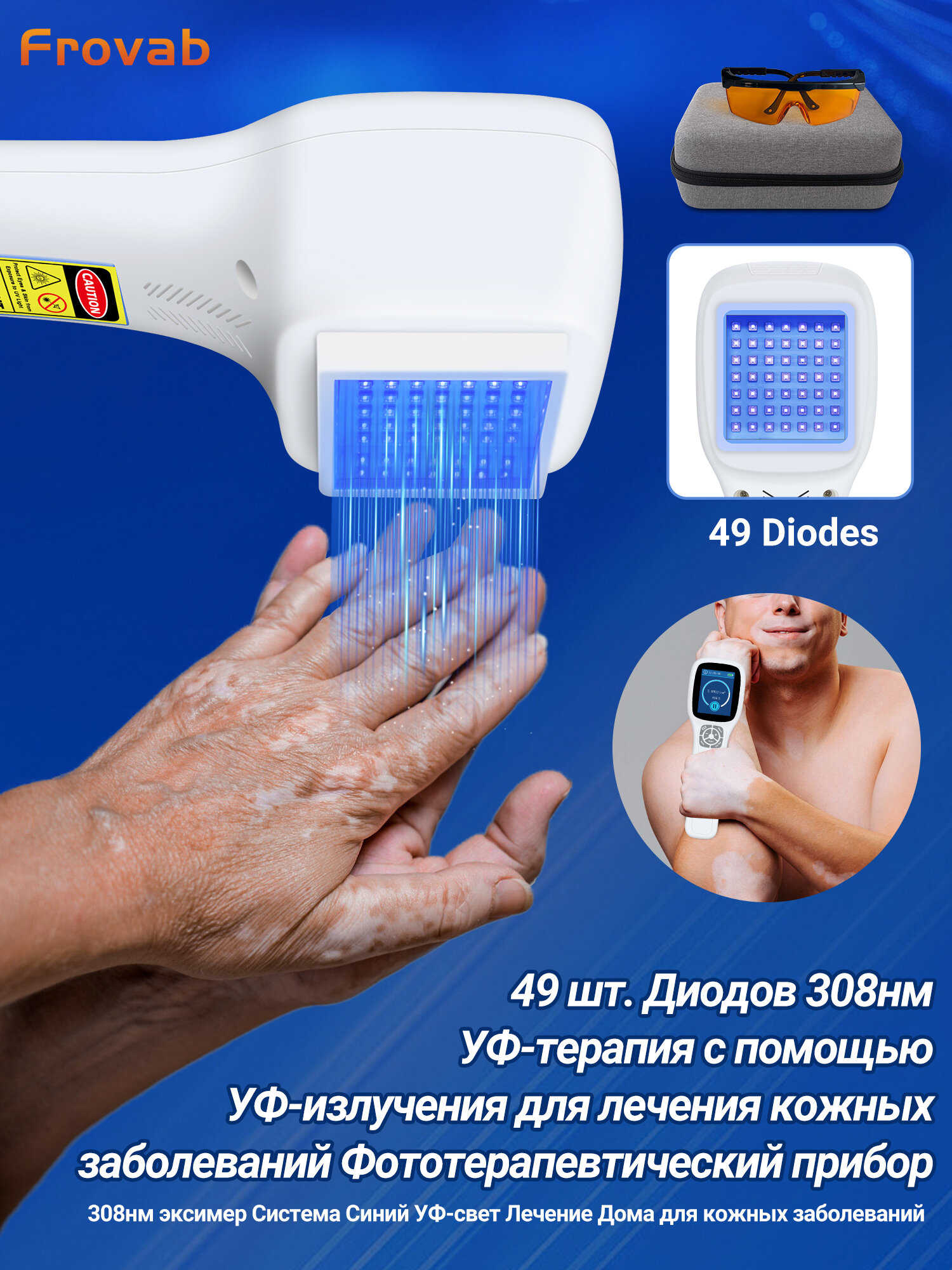 УФ-терапия Frovab 308нм 49 диода, доза 0-5 Дж/см², лечение псориаза, витилиго, дерматита и акне у взрослых