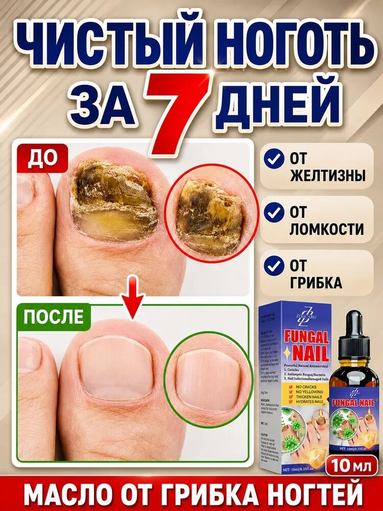 Масло от грибка ногтей, быстро устраняет грибок, желтизну, утолщение, ломкость и запах, глубокое очищение пластины, восстановление и защита для рук и ног, 30 мл