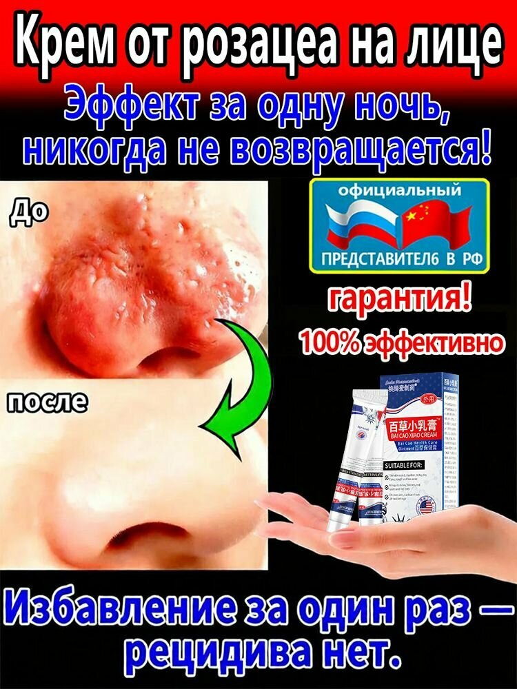 Антикуперозный крем для лица 20 мл, от купероза, розацеа, покраснений, прыщей и демодекоза, для лечения капилляров