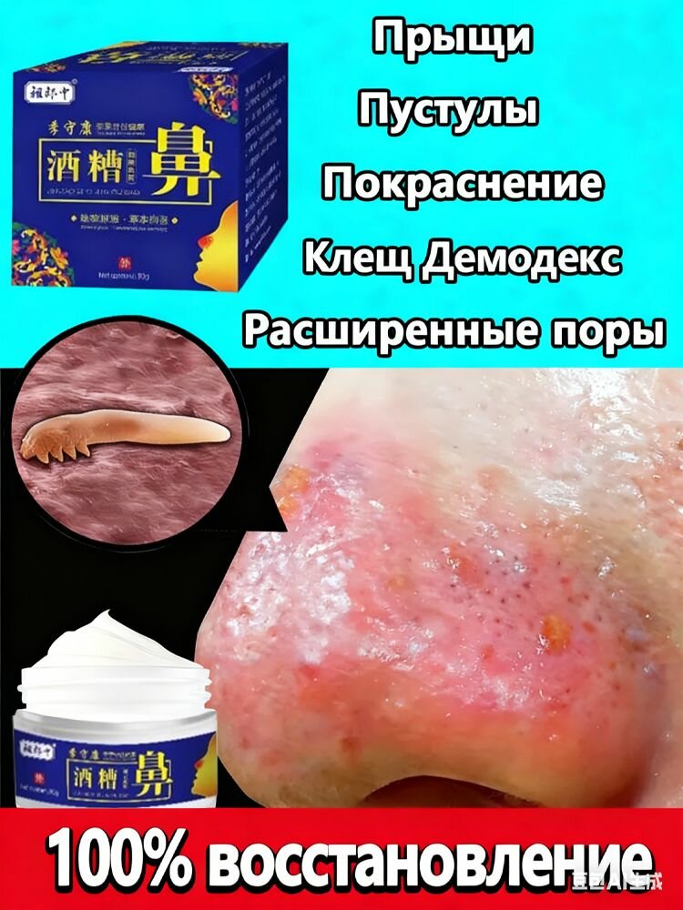 Гельтек Гель Демотен от прыщей акне демодекоза розацеа для проблемной и жирной кожи лица