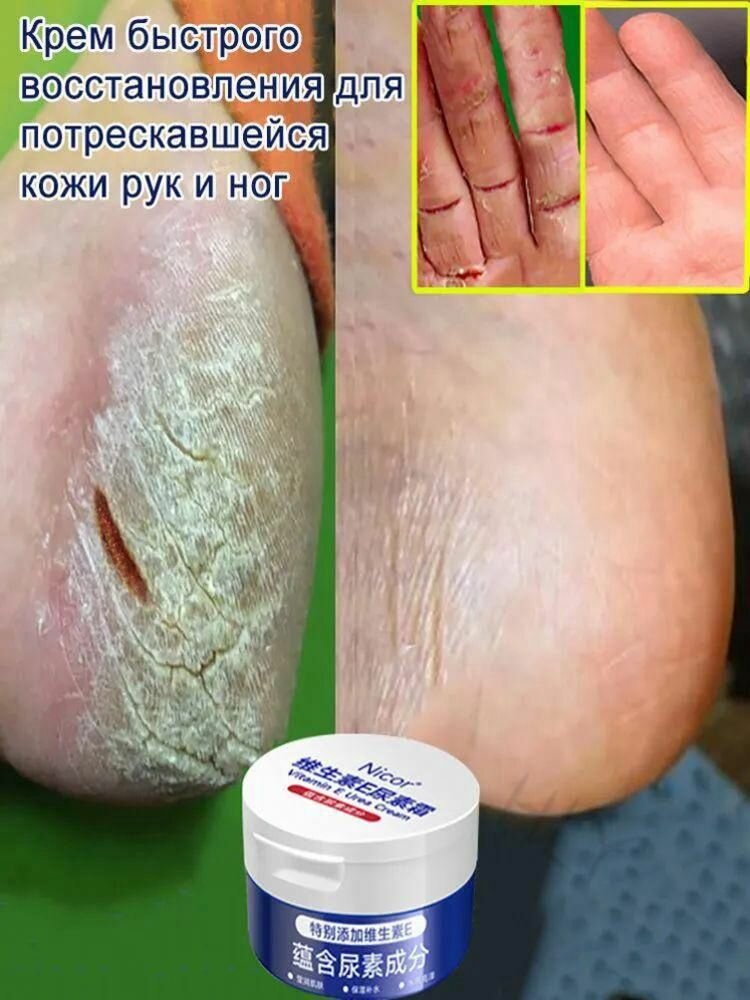Крем Мазь от трещин для сухой кожи ног и рук, заживление, , восстанавливающий и увлажняющий для грубой рук
