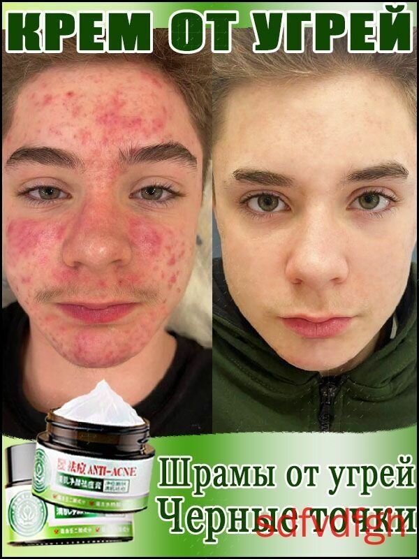 Салициловая мазь от прыщей, эффективно борется с воспалениями, направленная на акне и угри, прыщами и последствиями акне, подходит подросткам и проблемной коже, 30 г.