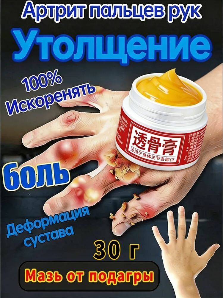 Мазь от подагры и артрита, обезболивающая мазь, 30 г для суставов от боли