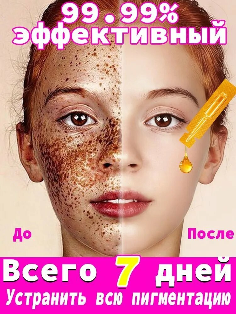 Удаляет пигментные пятна, веснушки, солнечные ожоги, лоазы, угревую сыпь, морщины. Устраняет пигментацию лица и тела и отбеливает кожу.150.6 мл