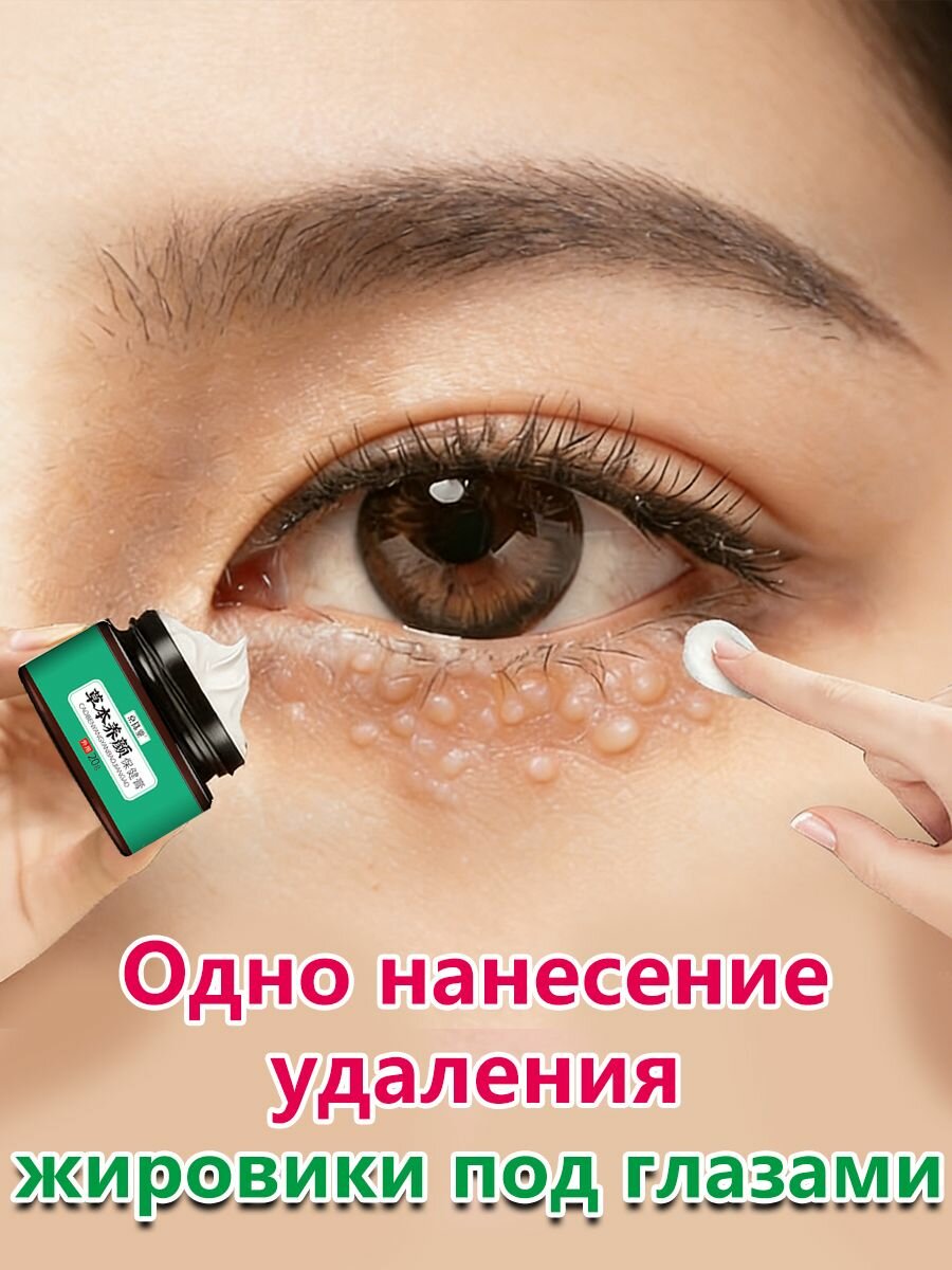 Мазь от жировиков под глазами Милиумы Просянка