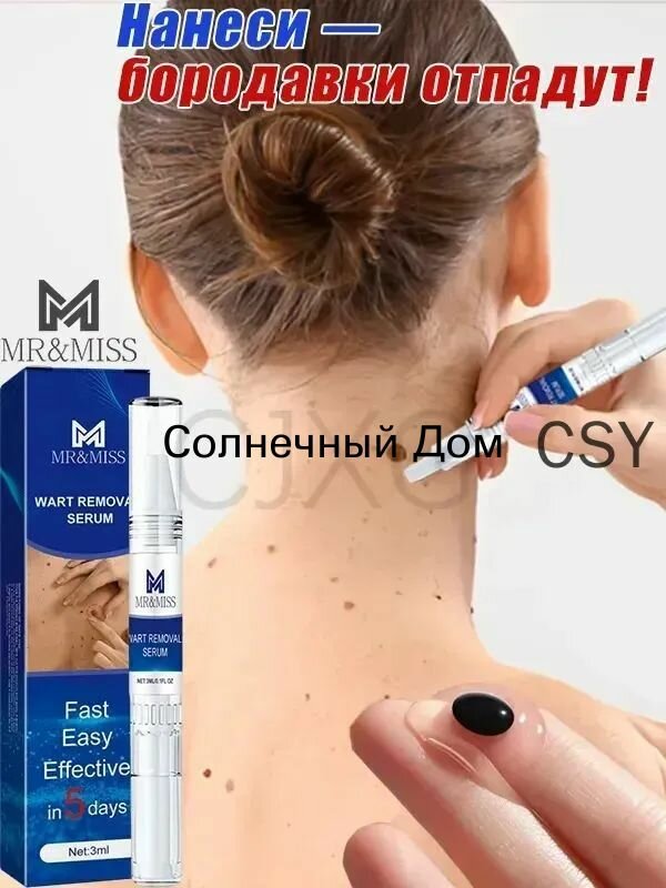 /Эссенция для удаления бородавок, папиллом и родинок, безболезненно, без шрамов и побочных эффектов.