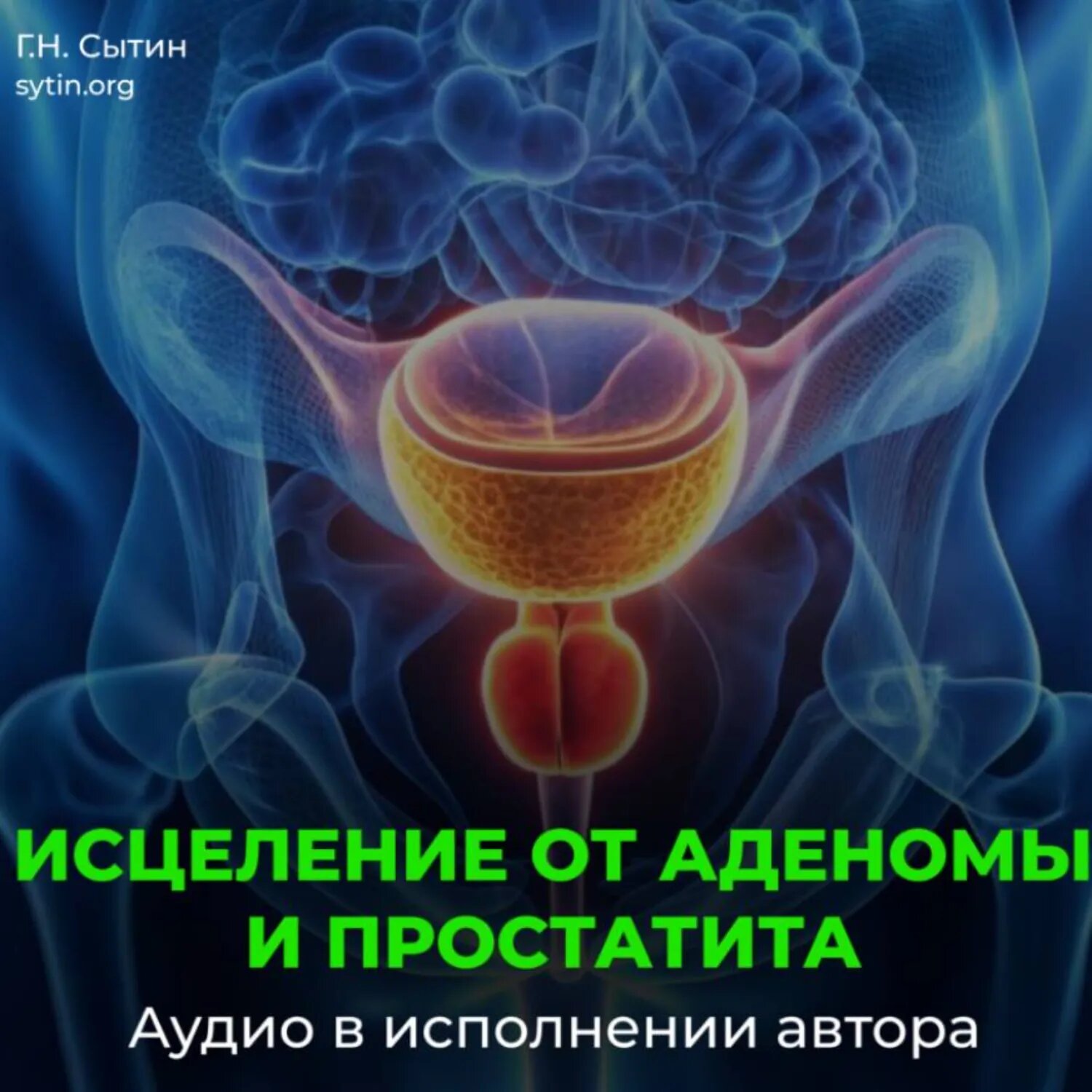 Настрой от аденомы простаты. Исцеление от простатита [Аудиокнига]