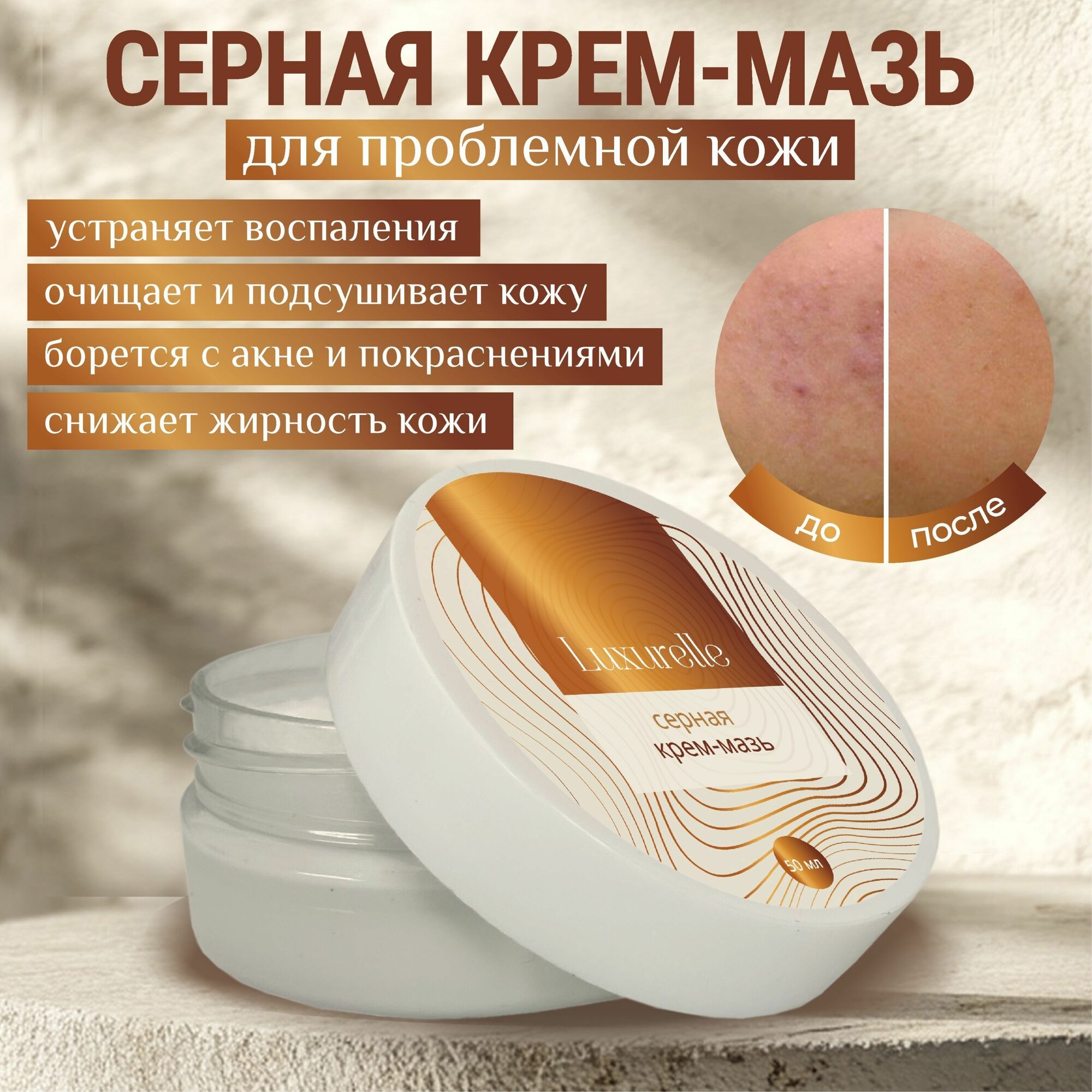 Luxurelle Серная мазь / крем-мазь против против кожных заболеваний, зуда, от псориаза, зуда, чесотки, герпеса, прыщей, 50 гр
