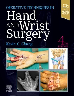 Operative Techniques: Hand and Wrist Surgery 9780323794152 Reprinted books