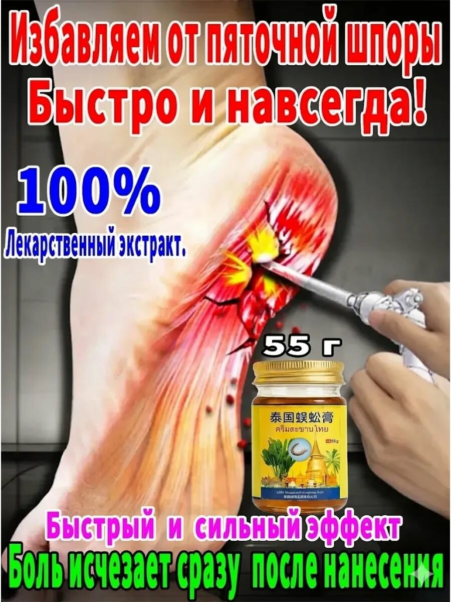 Пяточная шпора мазь