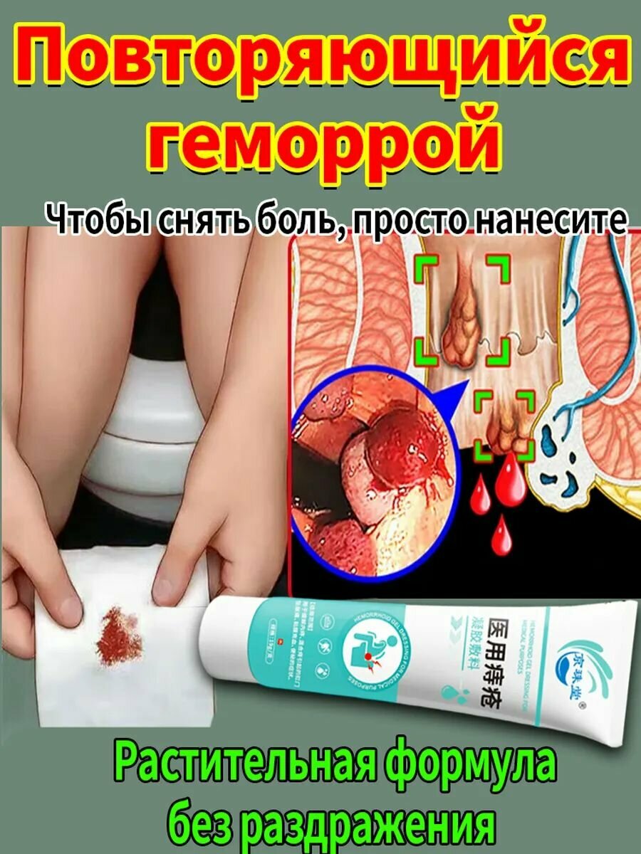 Мазь китайская мускусная от геморроя и трещин, обезболивающий крем
