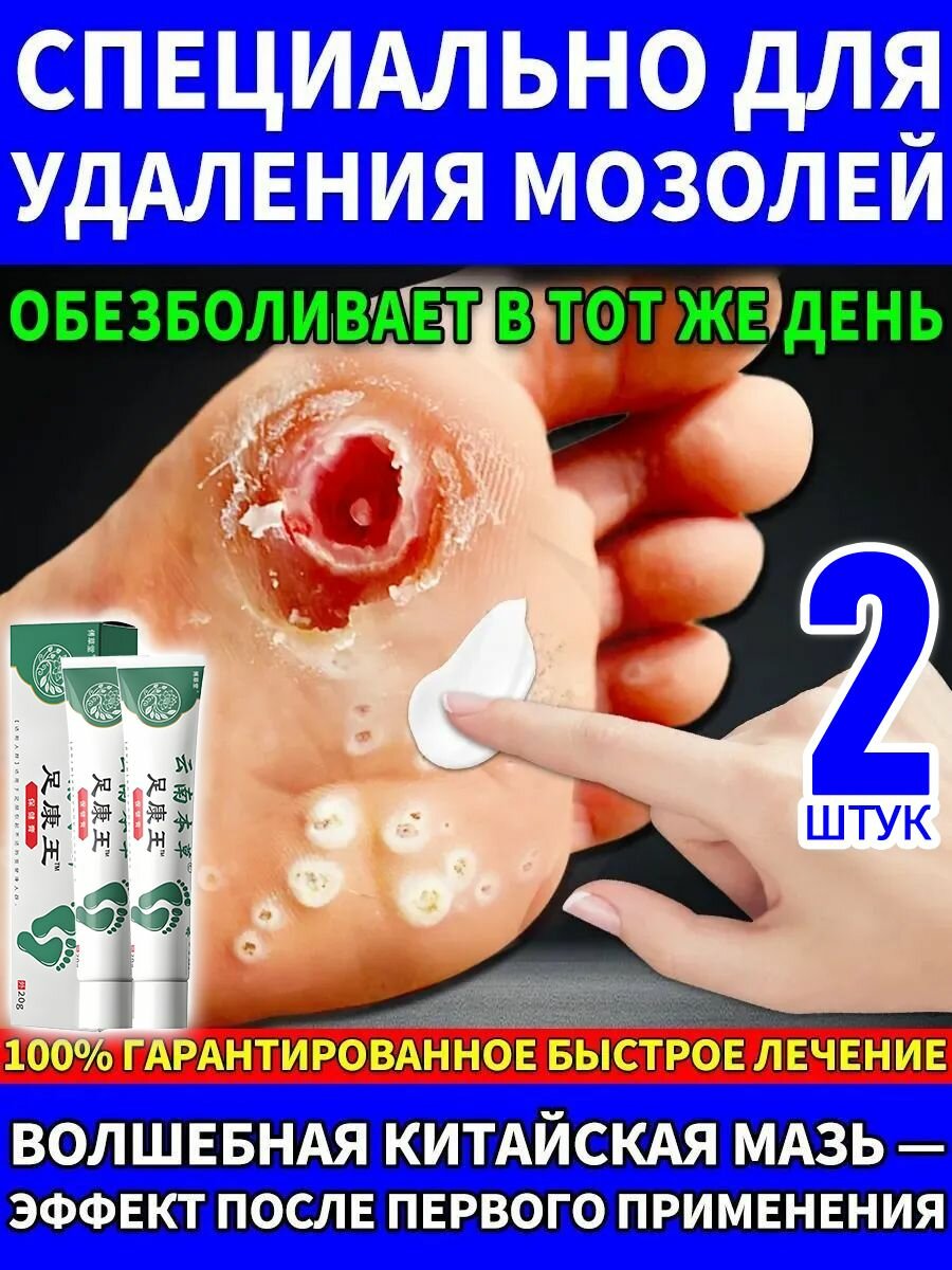 2 штуки, средство от натоптышей на ногах эффективное, средство от сухих мозолей стержневых на ногах