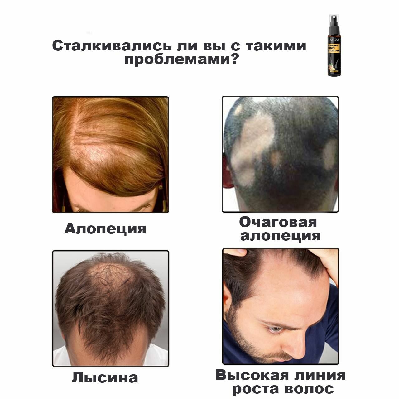 Спрей для роста бороды + ролик. EELHOE 30ml. — фото 1