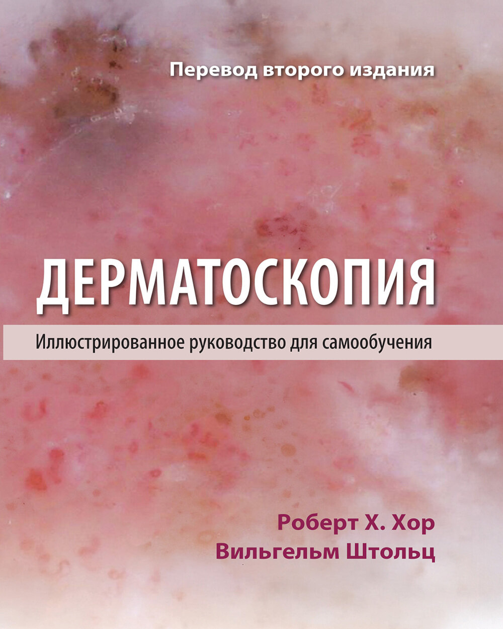 Дерматоскопия. Иллюстрированное руководство для самообучения. Хор Р. Х, Штольц В.