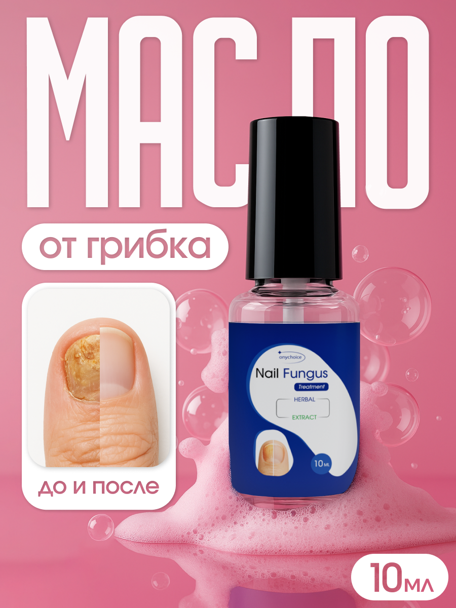 Лак для ногтей Nail Fungus, масло от грибка и онихолизиса, 10 мл