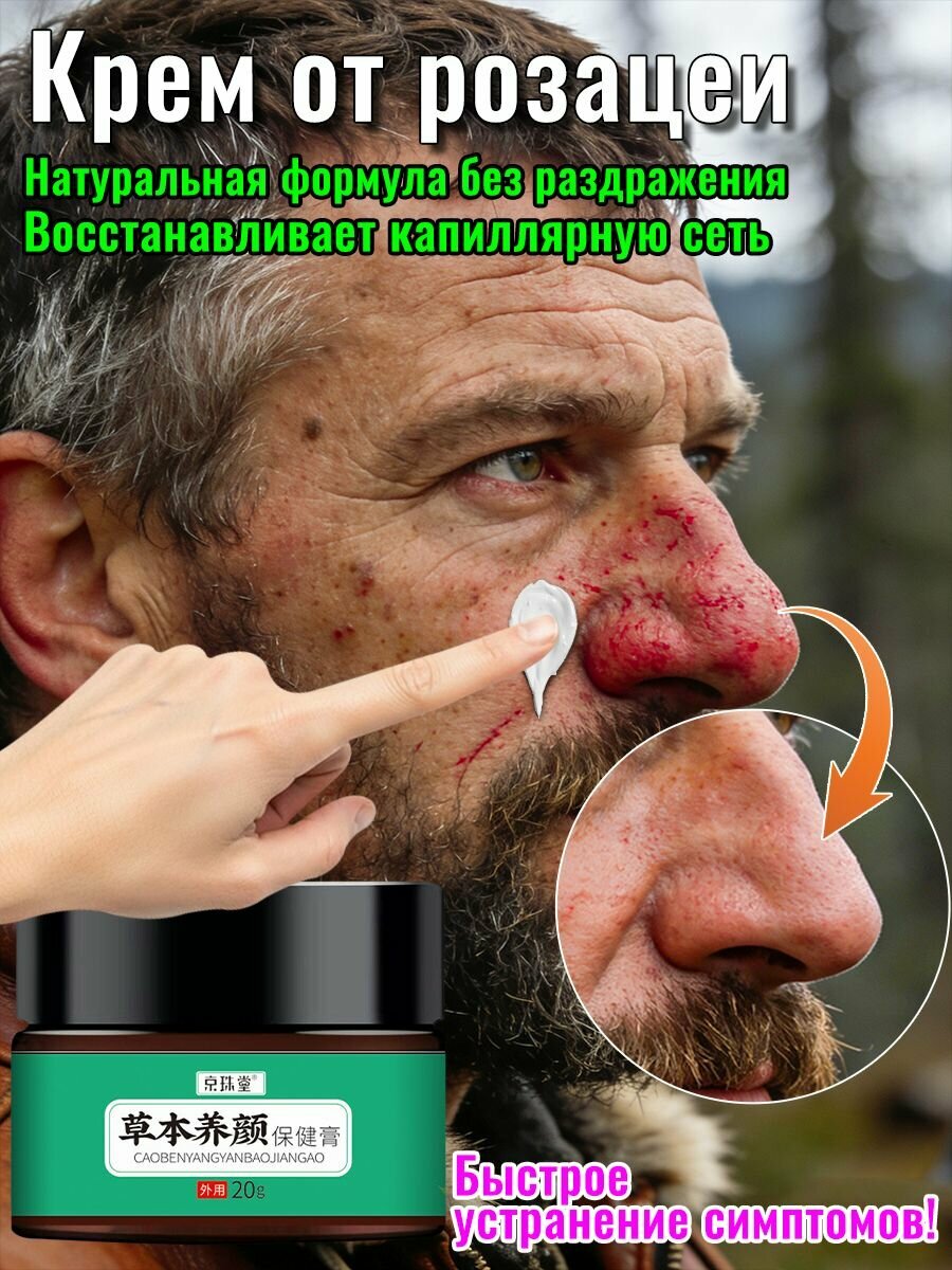 Мазь от Китайский розацеа на лице купероза и покраснений 20 грамм