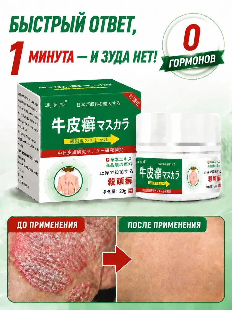 Мазь от псориаза, экземы и дерматита / Крем от грибка и лишая / Китайское средство от зуда в интимной зоне