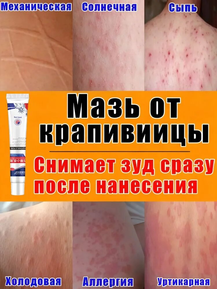 Мазь от крапивницы, Используется для лечения симптомов дерматита, крапивницы, экземы, зуда кожи, китайская чудо-мазь,20 г