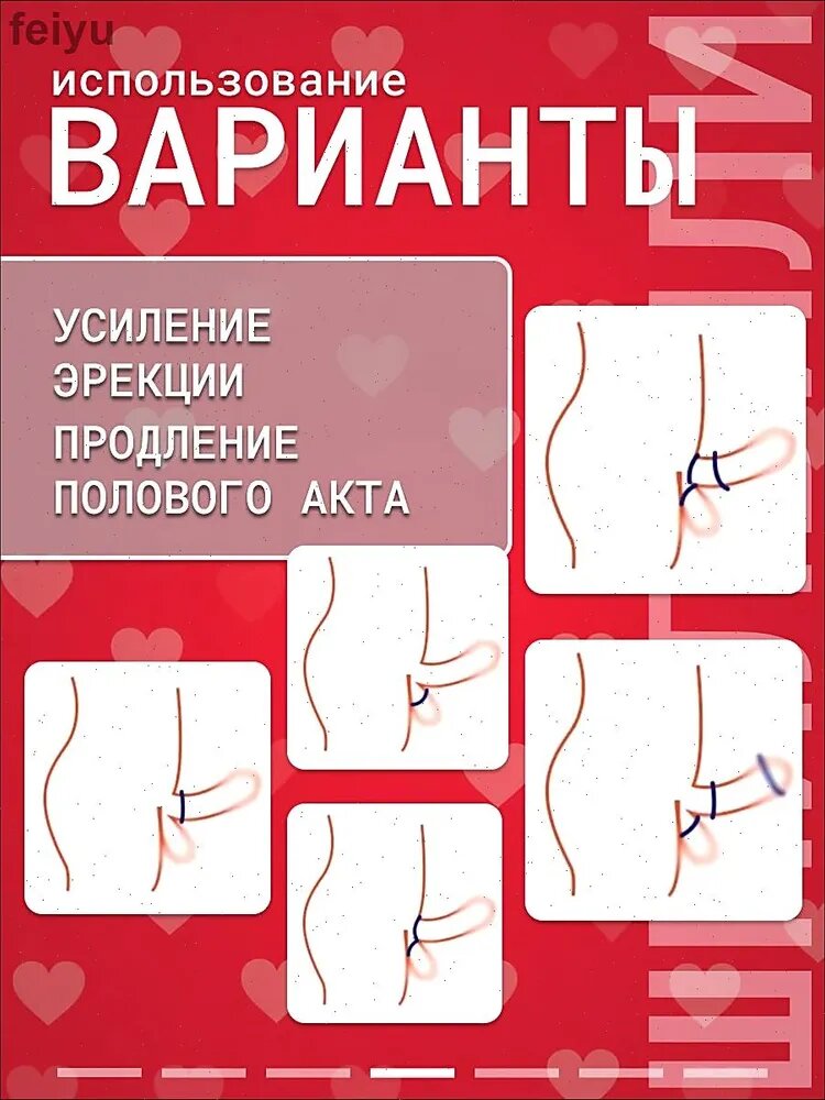 Эрекционное кольцо — фото 1