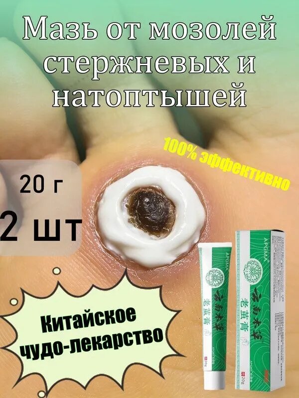 Mазь от мозолей стержневых и натоптышей , Крем от сухих мозолей, шипицы, бородавок, натоптышей,20 г 2 шт.