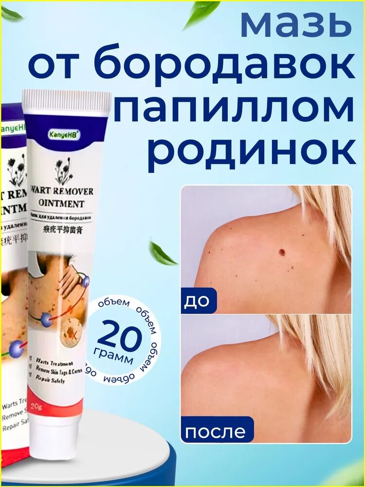 Папилофаг крем для ухода за кожей от папиллом и бородавок, средство против наростов, уход за проблемной кожей, 50 г