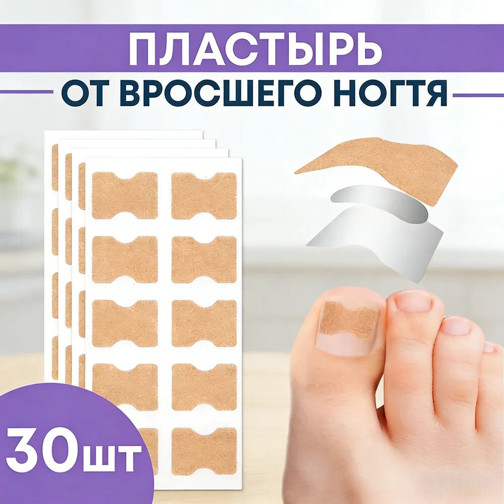 Корректор вросшего ногтя в домашних условиях 30 штук, Встроенный корректор ногтей на ногах