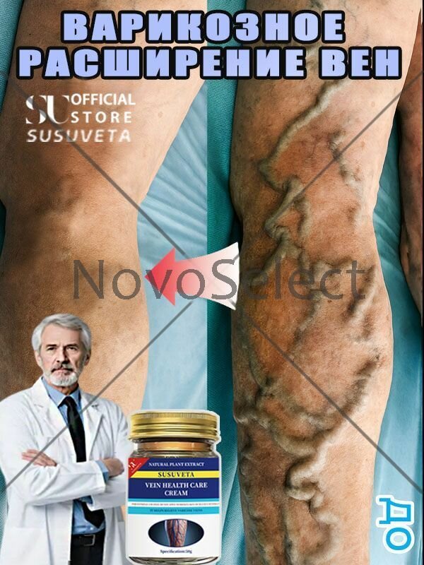 Крем от варикоза, сосудистых звездочек, Эффективен при лечении варикозного расширения вен, для сосудов, тромбоза, усталости и опухших ног, 50 мл