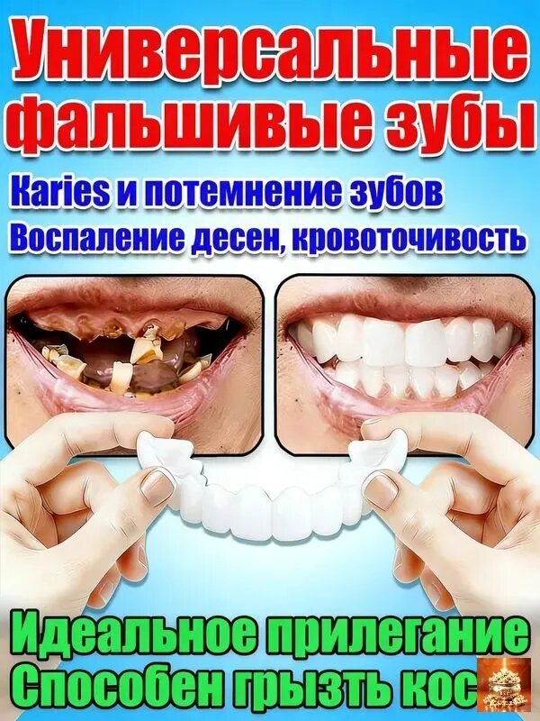 Декоративная временная пломба для зуба. Виниры для зубов накладные верхние и нижние силиконовые. Виниры. Брекеты. Материал пломбировочный временный