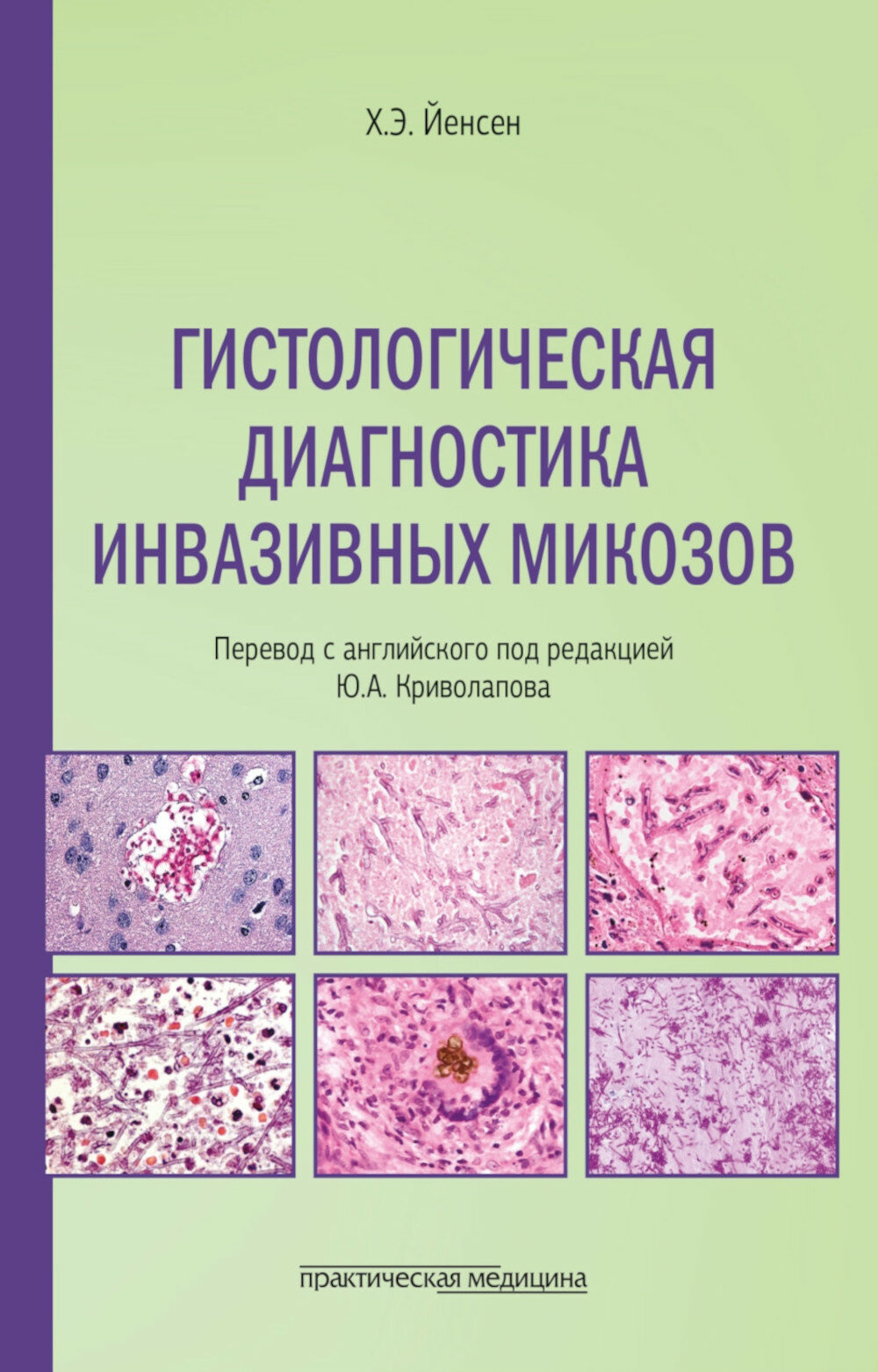 Гистологическая диагностика инвазивных микозов. Йенсен Х. Э.