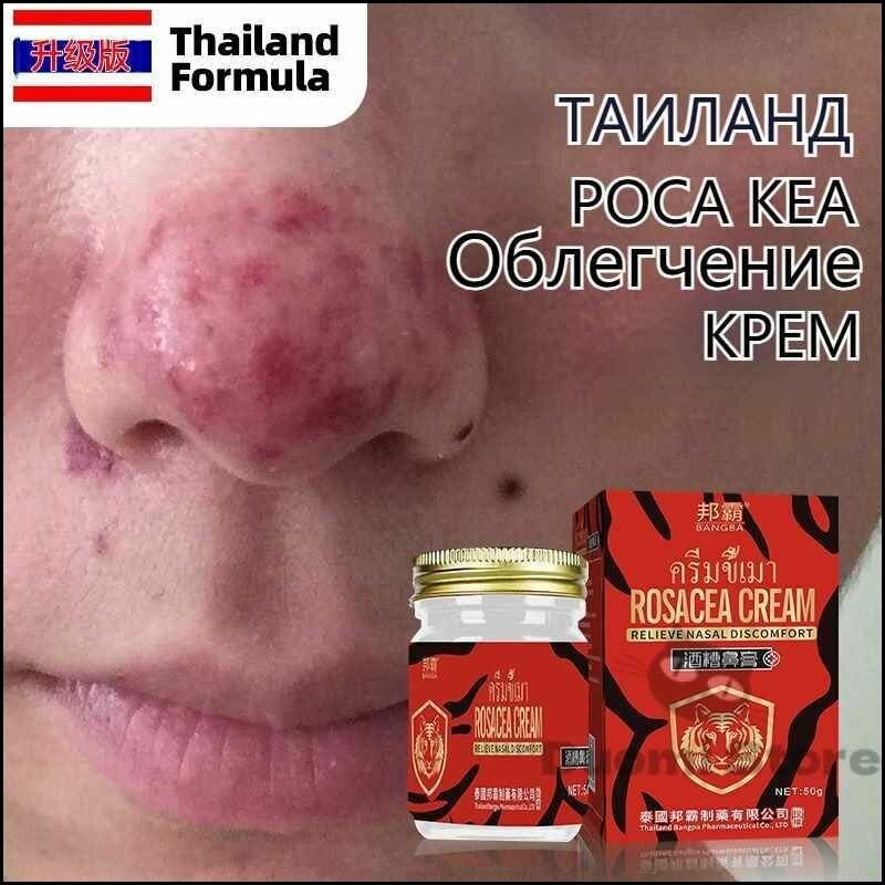 Крем от купероза и розацеа от покраснений и раздражений на коже,50 г, Тайский формула