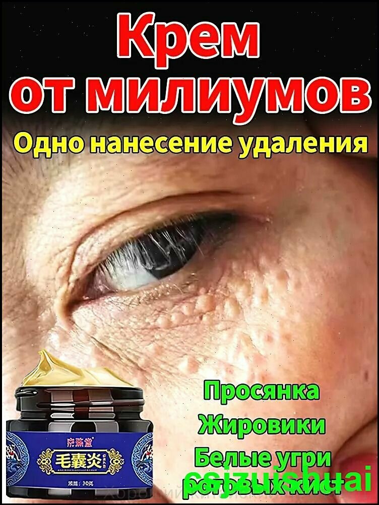 Эксклюзивная мазь против милиумов и просянки