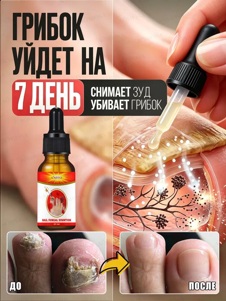 Для лечения грибка ногтей. руках, для лечения грибка и онихолизиса, противогрибковое для роста и укрепление.10мл