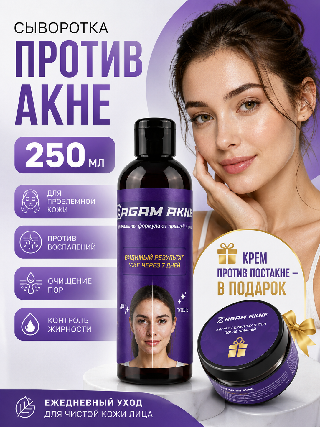 Средство для лечение проблемной кожи Загам Акне эффективное средство от прыщей и акне сыворотка