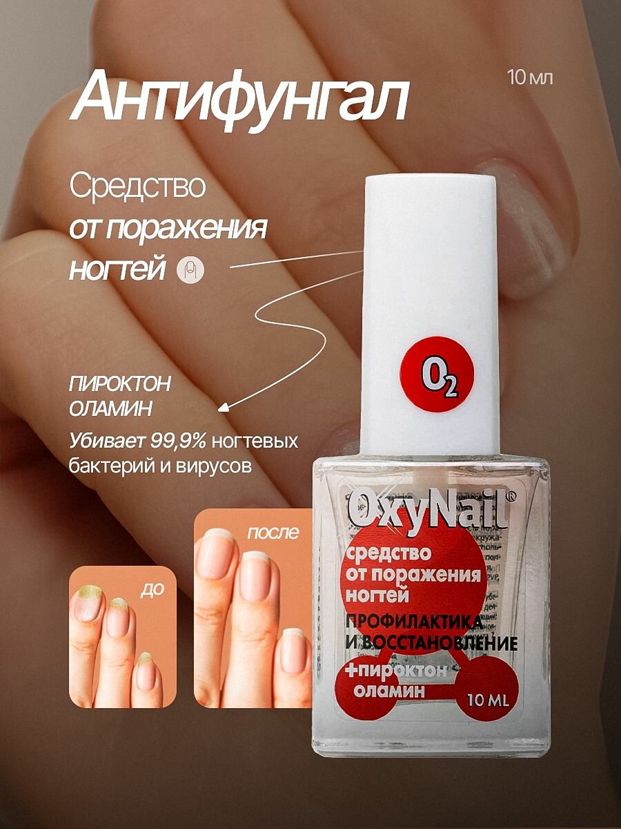 OxyNail Лак для ногтей антифунгал, лак от поражения ногтей на ногах и руках
