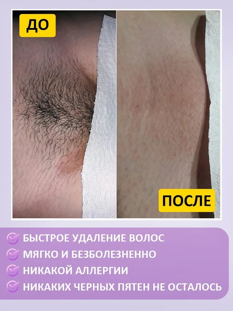 Крем для депиляции бикини 100 г Безболезненная депиляция, натуральные растительные экстракты, замедление роста волос, безопасно и без побочных эффектов