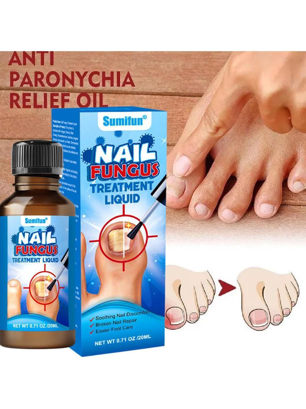 Масло для ногтей от грибка, средство для лечения грибка NAIL, 20 мл.
