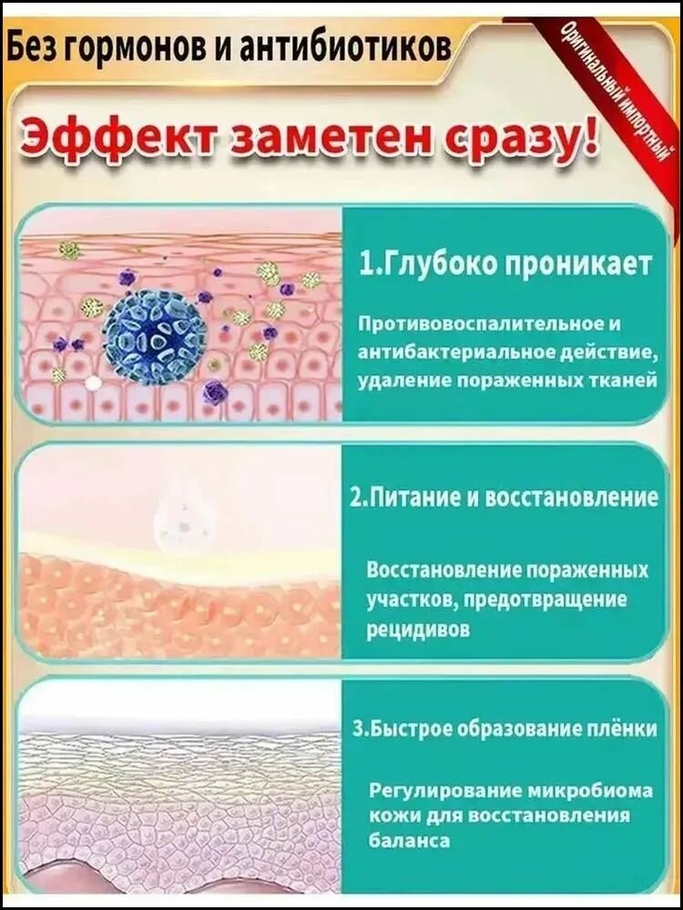 Крем от чириев и воспаленных угрей: глубокая обработка пор и заживление