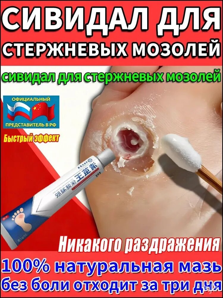 Эксклюзивная мазь и гель Корнекс, эффективное китайское средство для удаления шипиц, натоптышей и сухих стержневых мозолей на ногах