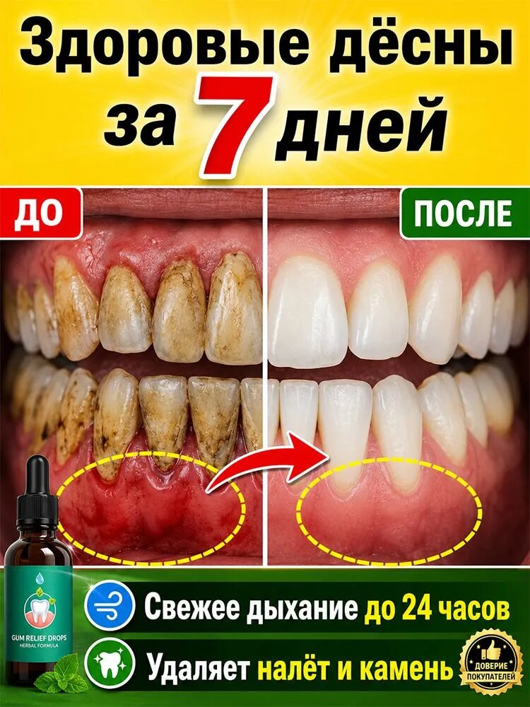 Масло для полости рта быстро подавляет бактерии и зубной налет, профилактика кариеса, кровоточивости, боли и отека десен, свежее дыхание, укрепление эмали, снижение чувствительности, 30 мл