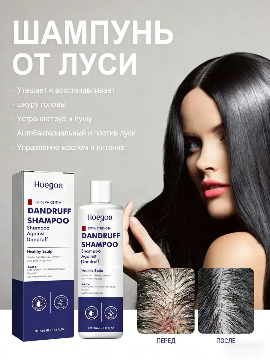 Шампунь против перхоти, уход за кожей головы, очищение и уменьшение зуда, растительные экстракты